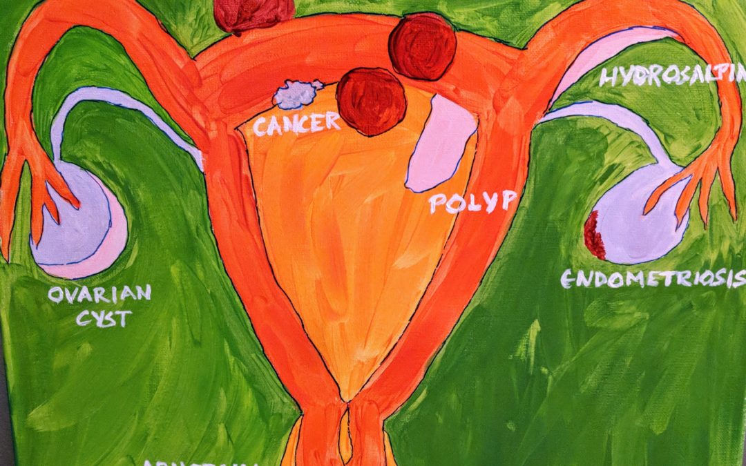 Endometrial evaluation in office - Walk In Gyn Care